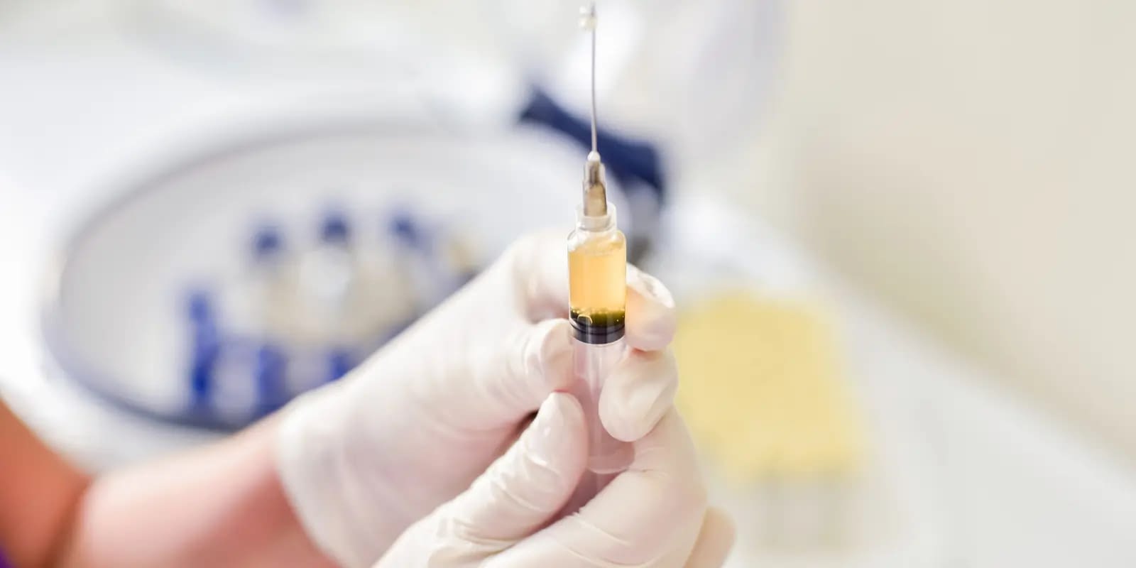 ¿Qué es el PRP? ¿Para qué sirve?